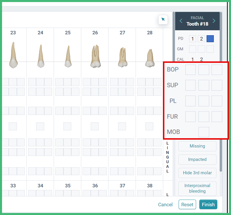 Description of Gum Measurements for Periodontal Charting – CareStack