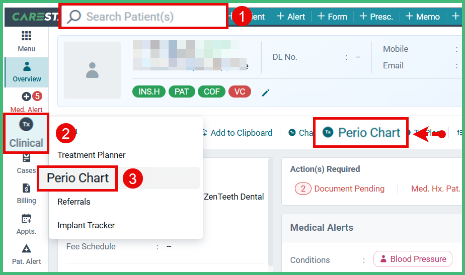 Explore the Perio Charting Process in CareStack – CareStack