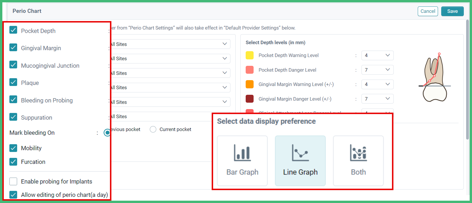 Configure Perio Charting and Manage Permissions – CareStack