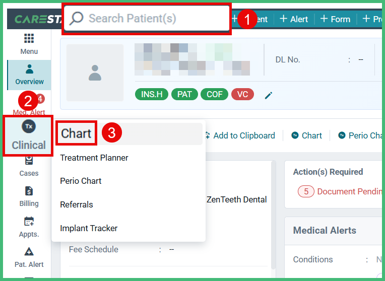 Explore the Basic Periodontal Examination Feature (BPE) – CareStack