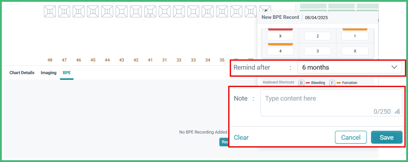 Explore the Basic Periodontal Examination Feature (BPE) – CareStack