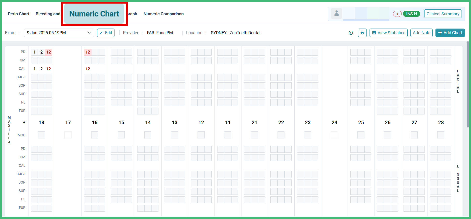 Description of Gum Measurements for Periodontal Charting – CareStack