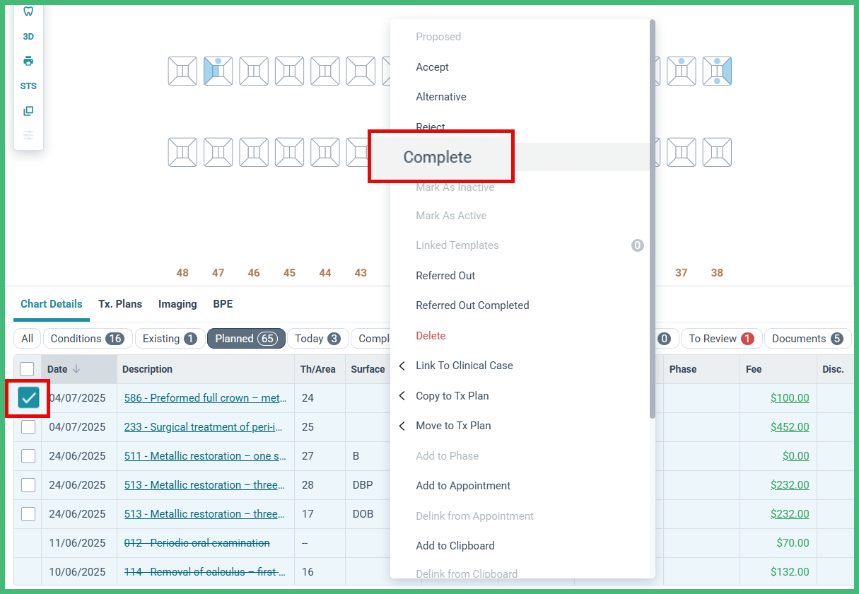 A Guide to the Odontogram (Charting) – CareStack
