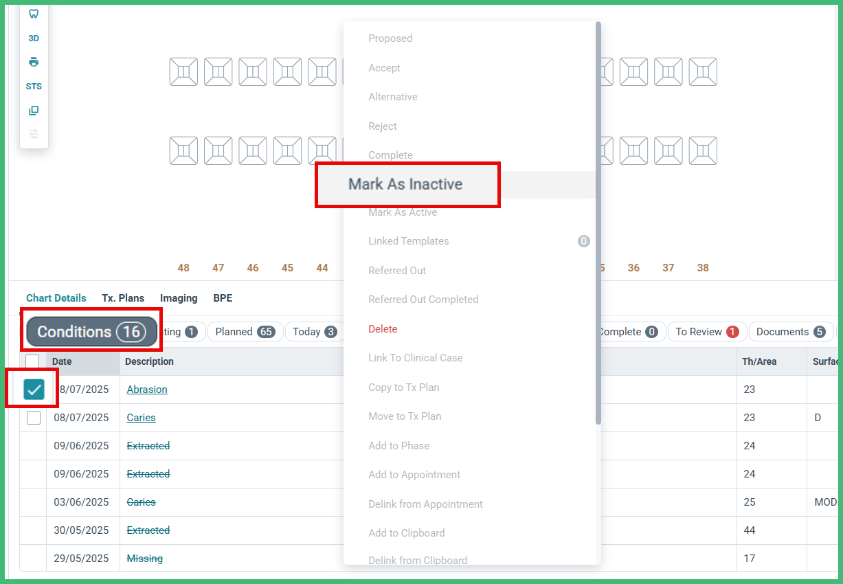 A Guide to the Odontogram (Charting) – CareStack