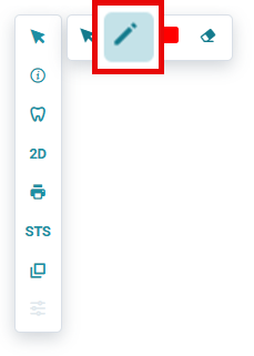 A Guide to the Odontogram (Charting) – CareStack