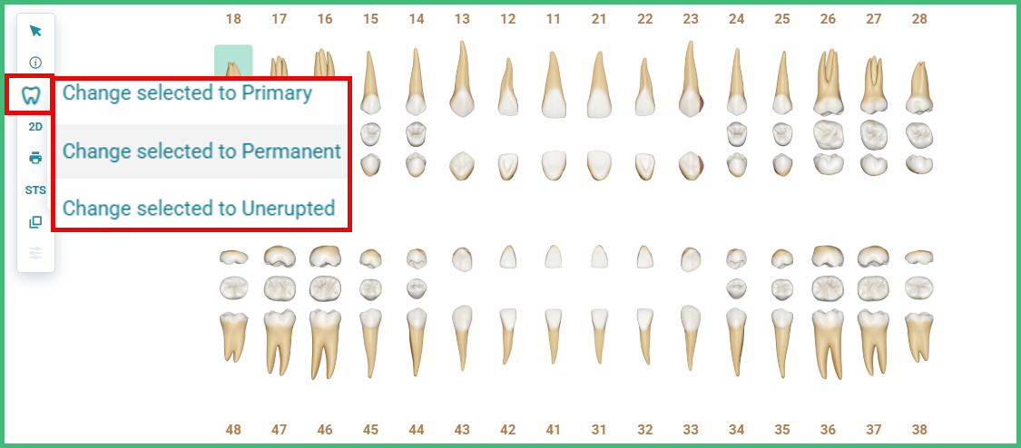 A Guide to the Odontogram (Charting) – CareStack