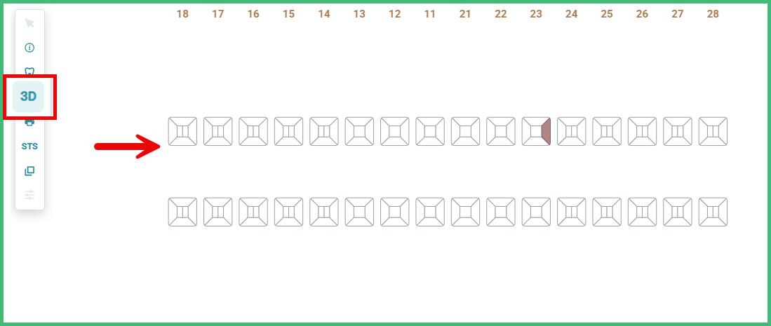 A Guide to the Odontogram (Charting) – CareStack