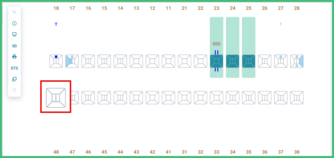 A Guide to the Odontogram (Charting) – CareStack