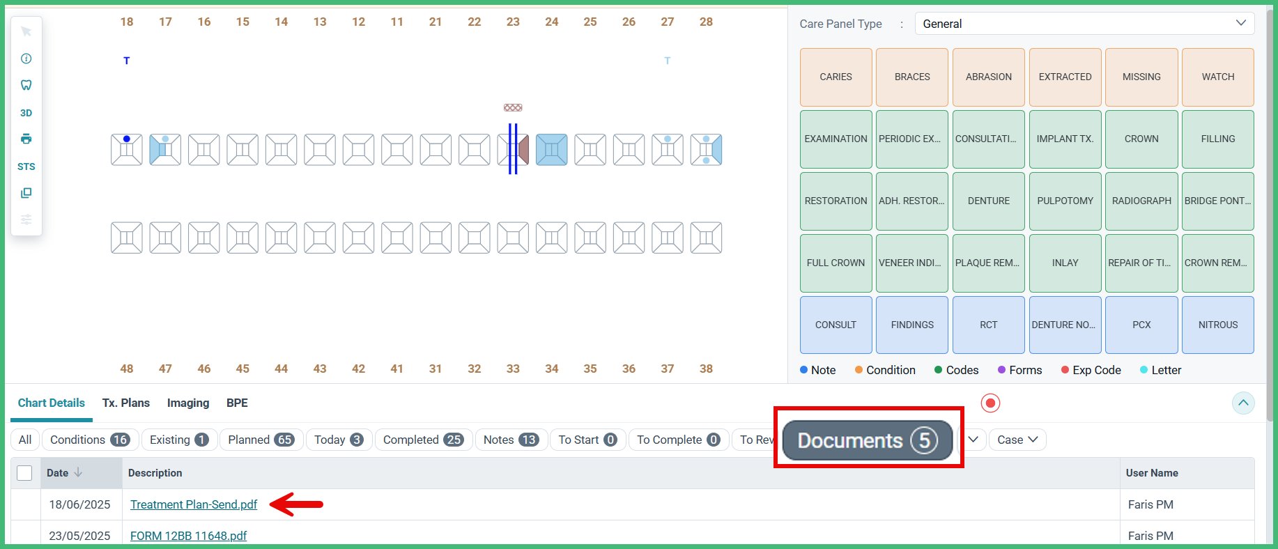 A Guide to the Odontogram (Charting) – CareStack