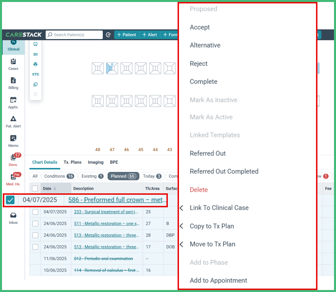 A Guide to the Odontogram (Charting) – CareStack