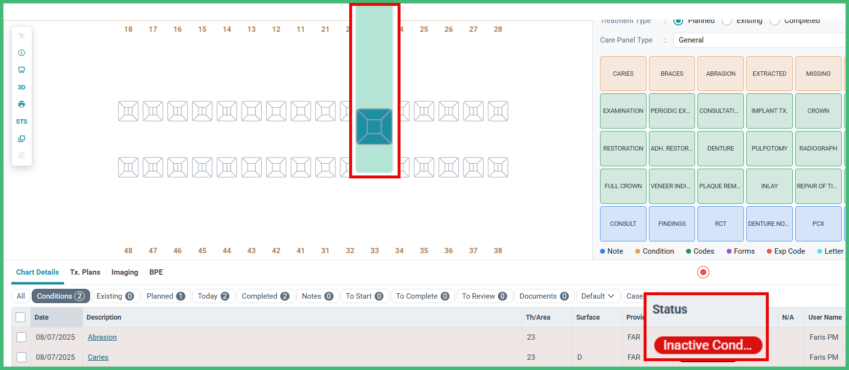 A Guide to the Odontogram (Charting) – CareStack