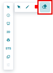 A Guide to the Odontogram (Charting) – CareStack