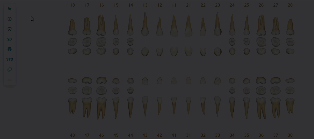 A Guide to the Odontogram (Charting) – CareStack