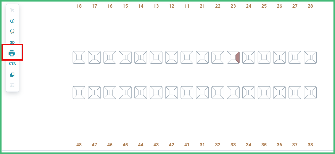 A Guide to the Odontogram (Charting) – CareStack