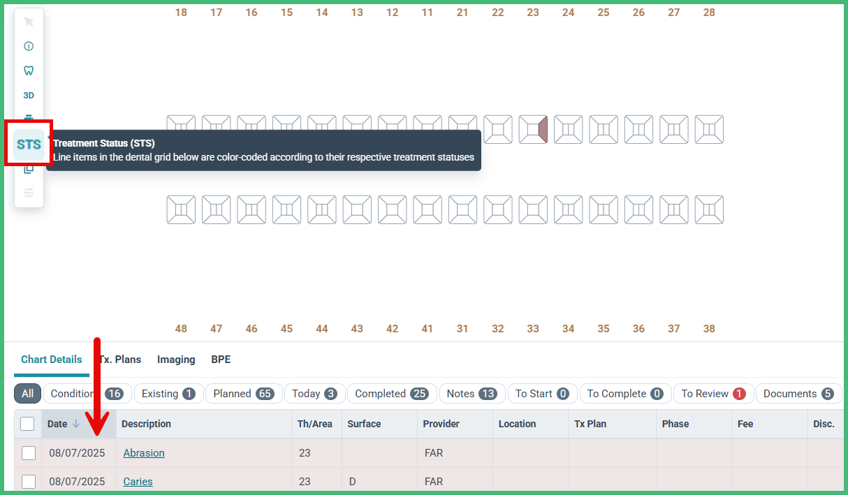 A Guide to the Odontogram (Charting) – CareStack