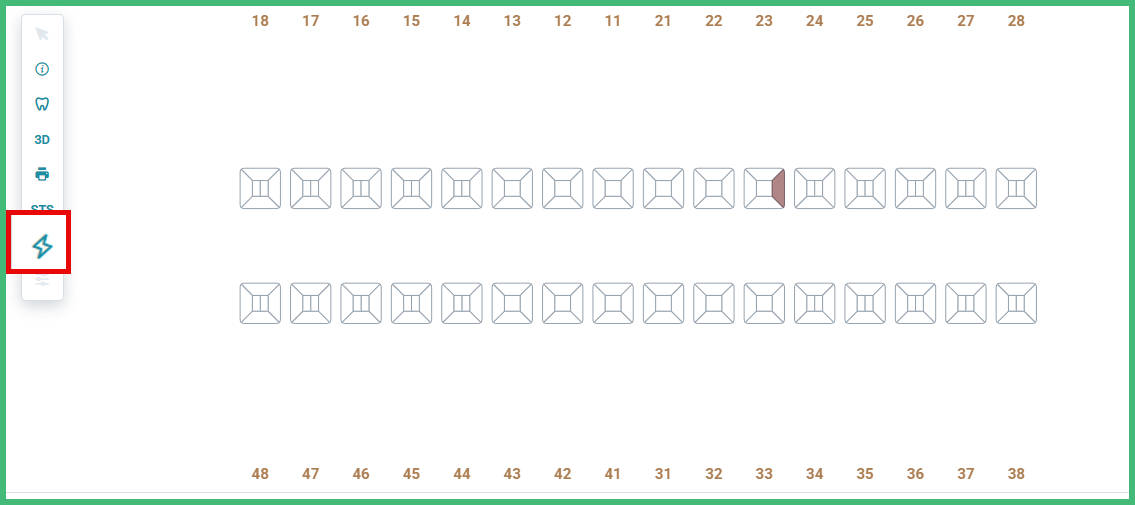 A Guide to the Odontogram (Charting) – CareStack