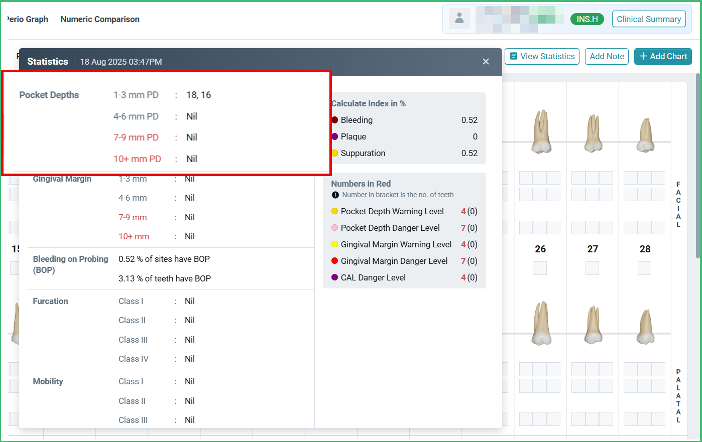 View Statistics in Perio Chart – CareStack