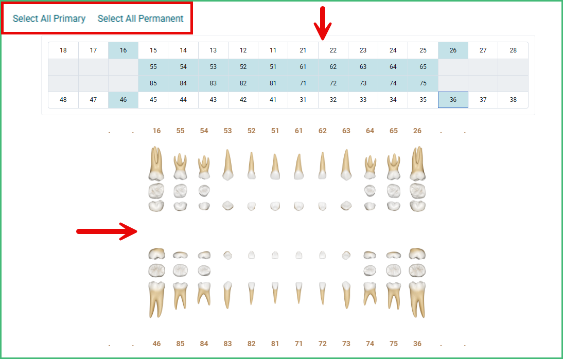 Add a Custom Dentition for a Specific Age Range – CareStack