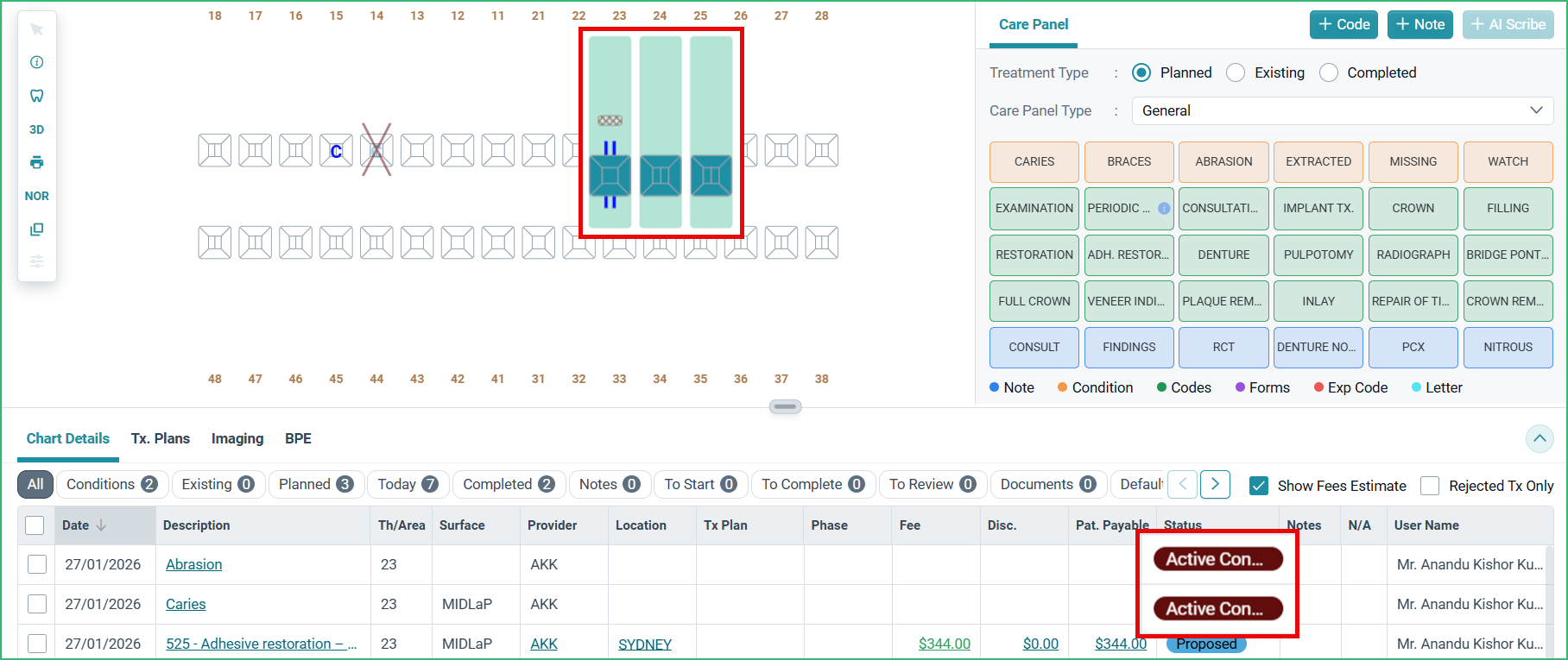 A Guide to the Odontogram (Charting) – CareStack