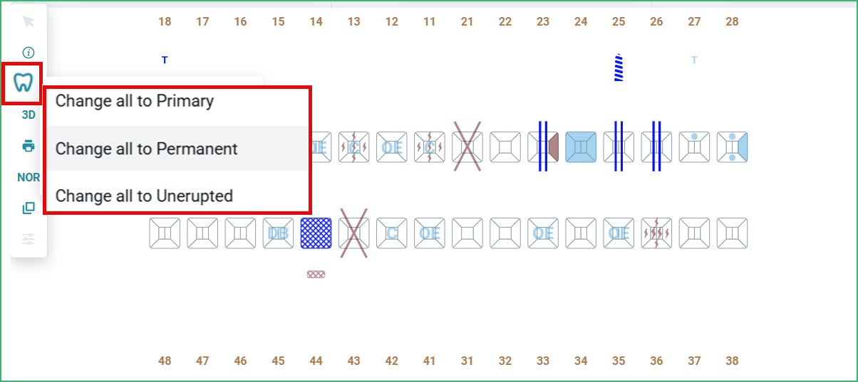 A Guide to the Odontogram (Charting) – CareStack