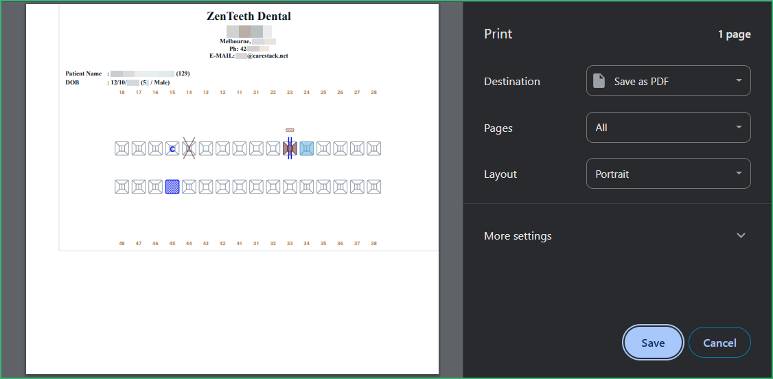 A Guide to the Odontogram (Charting) – CareStack