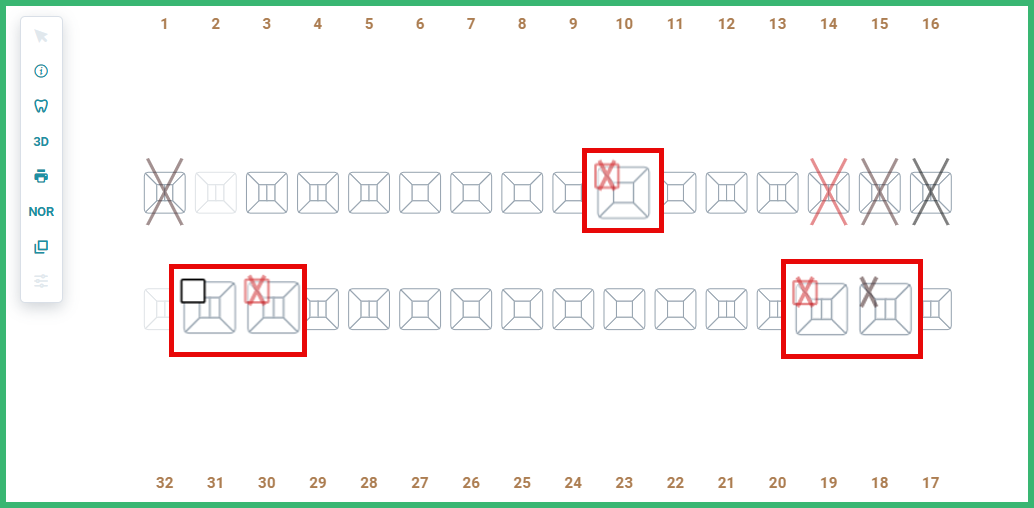 A Guide to the Odontogram (Charting) – CareStack